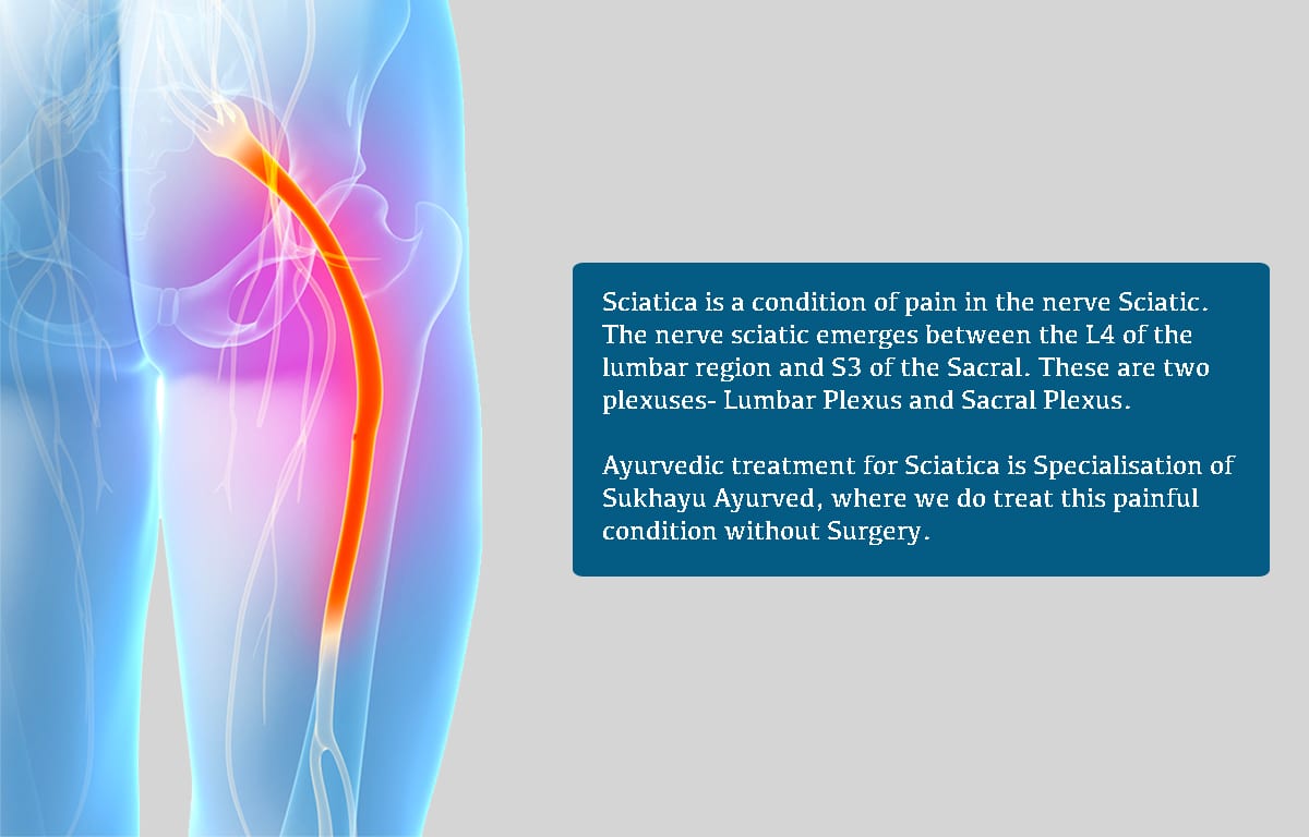 Ayurvedic Treatment for Sciatica: Avoid the probable Surgery